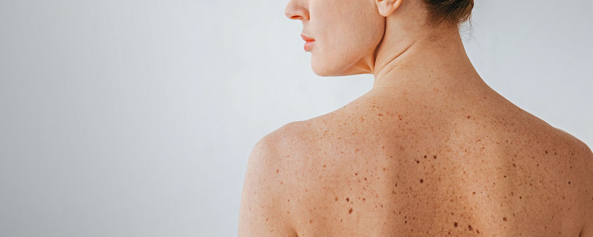 DERMIS Dermatology Clinic, Zurich, Switzerland